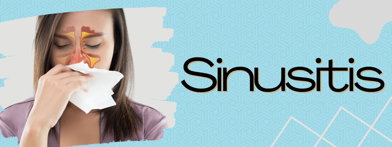 Sinusitis - ExcelENT