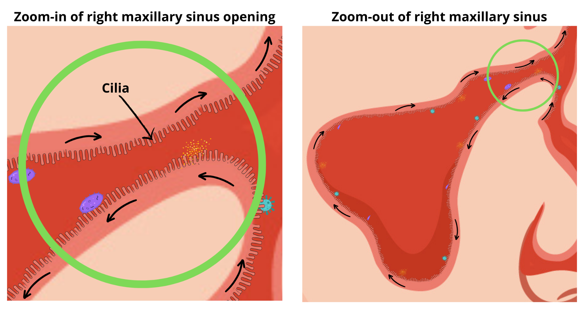 Sinus Congestion - ExcelENT